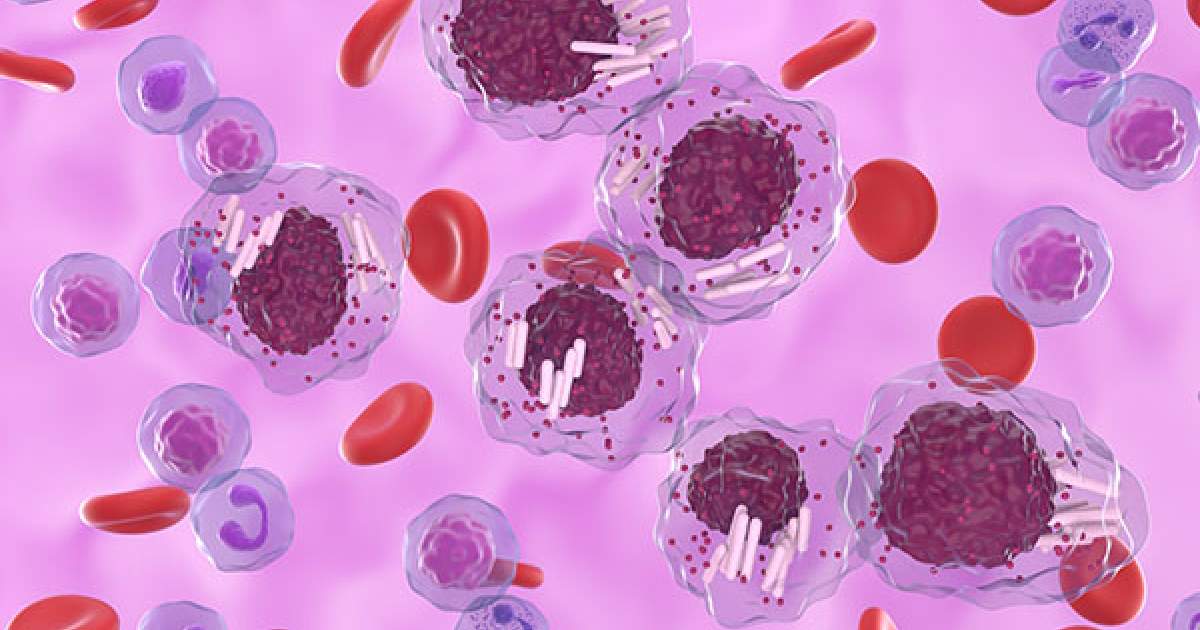 Cancer – Chronic Lymphocytic Leukemia | AMCP.org